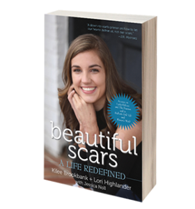 Rave Reviews for 'Beautiful Scars' - KiCam Projects
